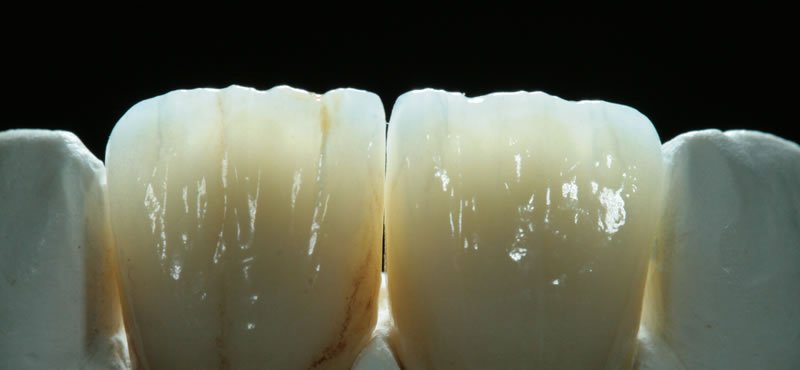 Dicas para verificar a cor e demais peculiaridades dos dentes